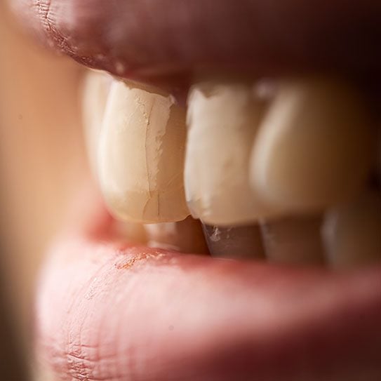 What Can Be Done for Cracked Teeth? - Endodontics Colorado Springs ...